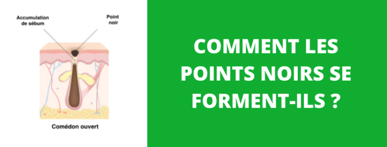 Comment enlever les points noirs ? [7 solutions pour vous en débarrasser]